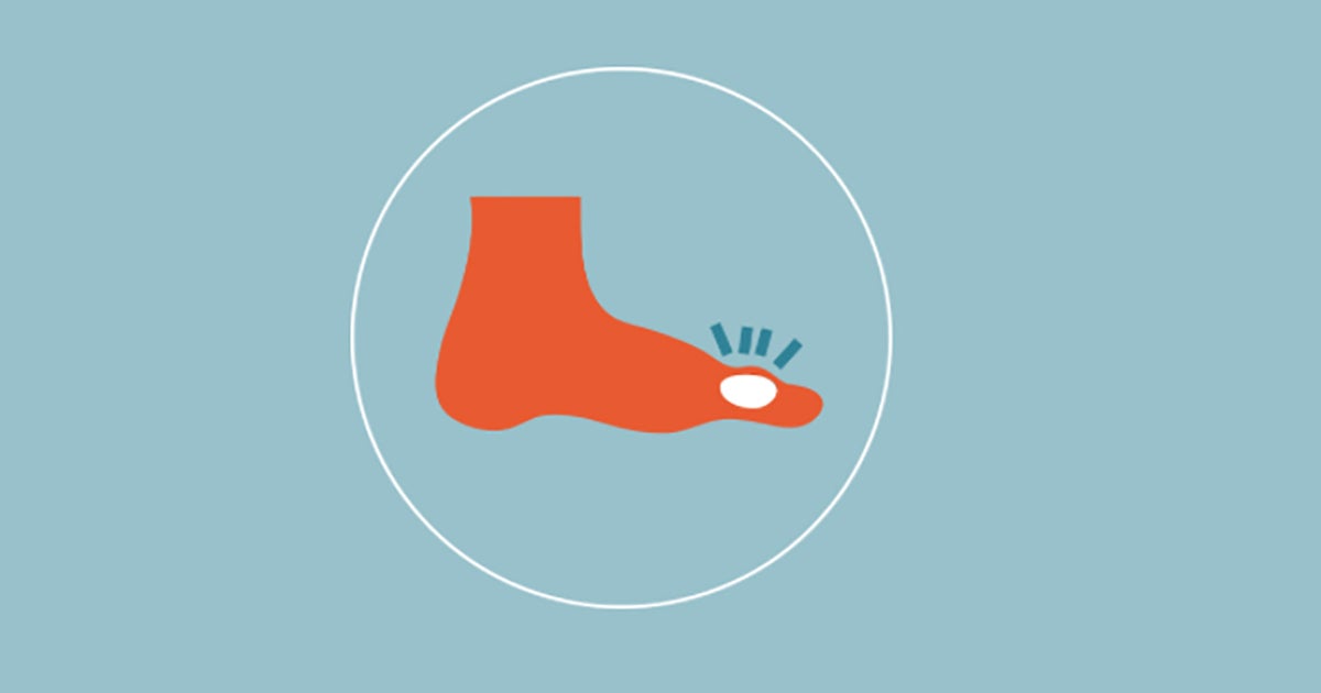 Do You Have Intense Joint Pain? You May Have Gout | National Kidney ...